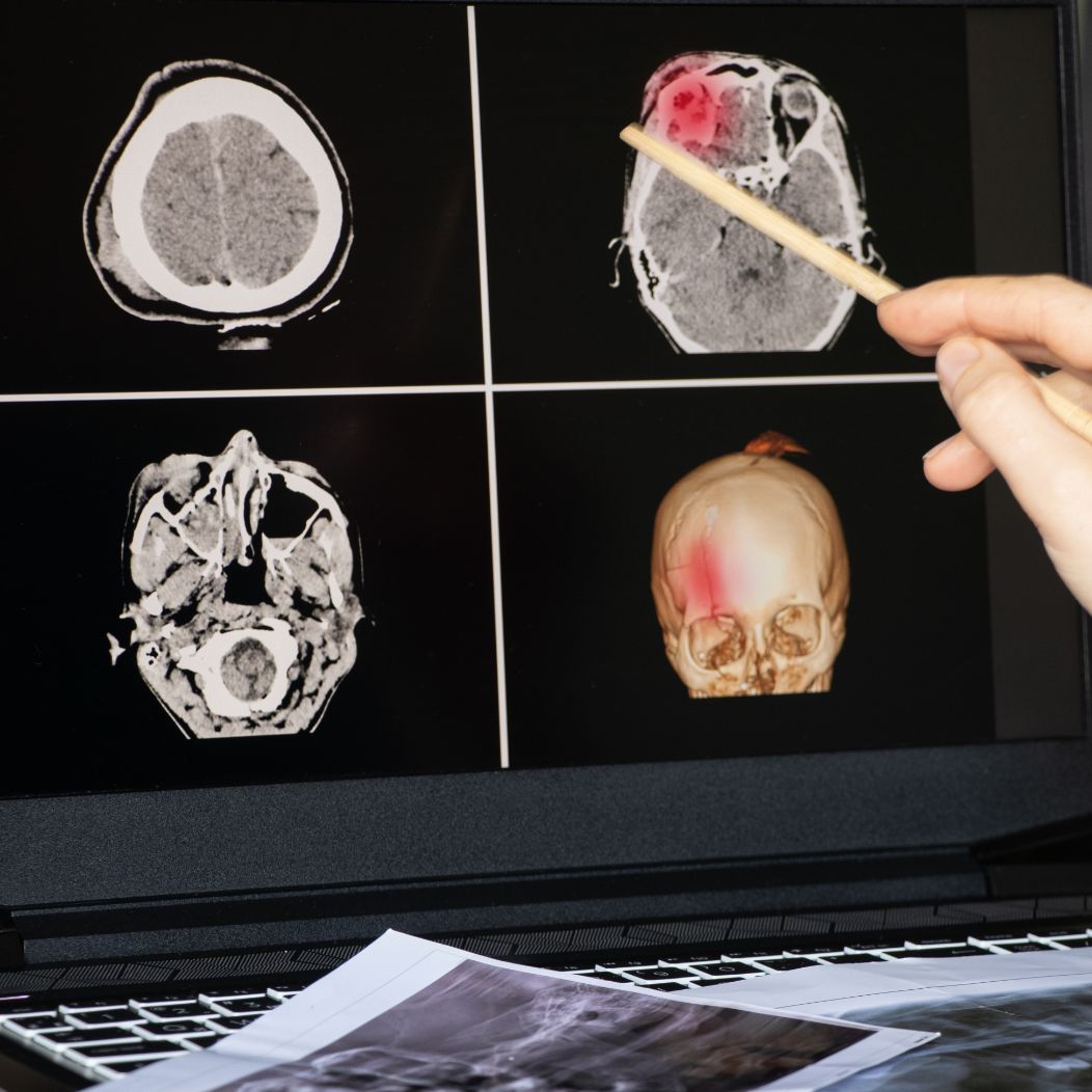 Facial Trauma Aurora, CO - Saddle Rock Institute